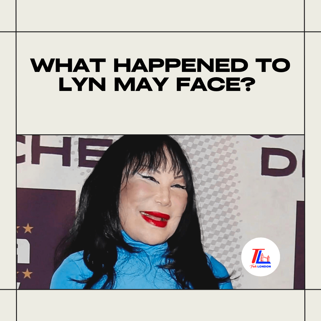 What Happened to lyn May Face? Facts Revealed | TrekLondon