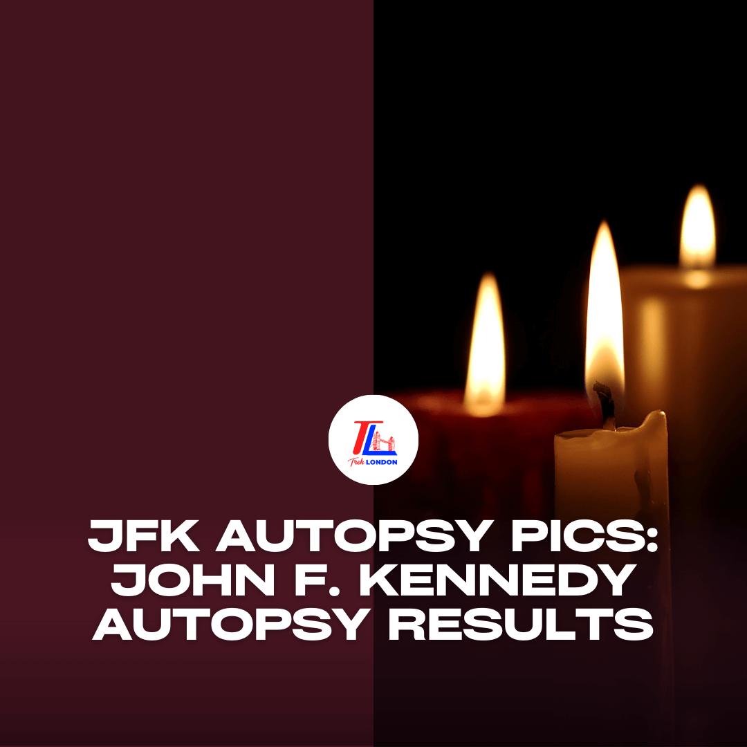 JFK Autopsy Pics: John F. Kennedy Autopsy Results | TrekLondon