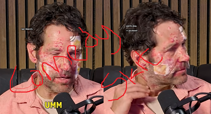 Paul Rudd Burn Real or Fake? Viral Ambulance Scene Was a Staged Comedy ...